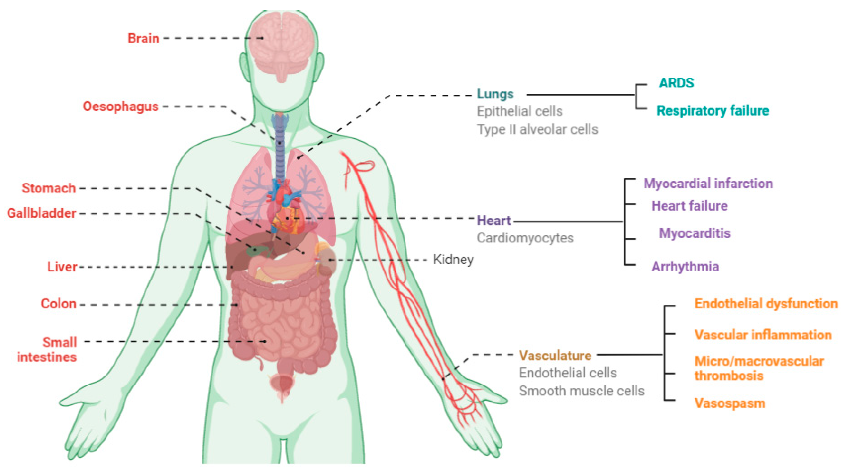 Biologics | Free Full-Text | Overview of COVID-19 Disease: Virology ...