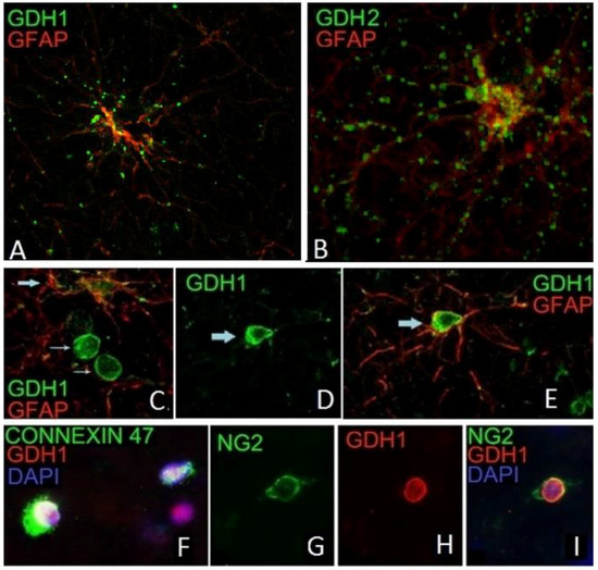 The Glutamate Dehydrogenase Pathway and Its Roles in Cell and Tissue ...