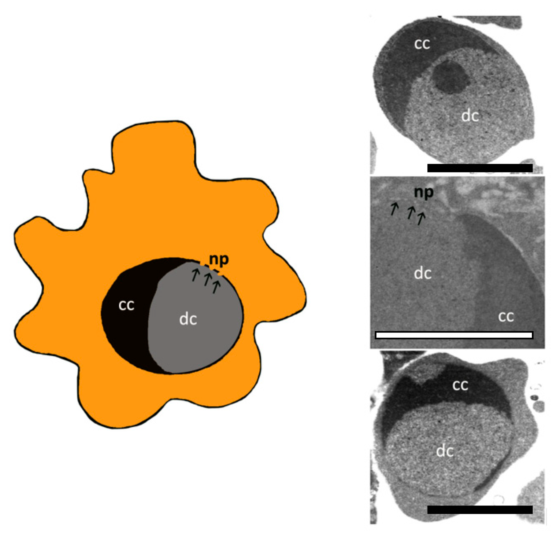 Apoptotic Bodies: Particular Extracellular Vesicles Involved in ...