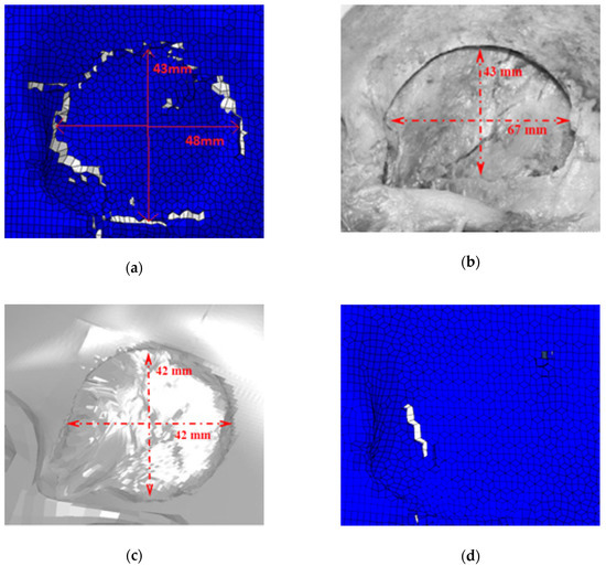 Computational Modeling of Skull Bone Structures and Simulation of Skull Fractures Using the ...