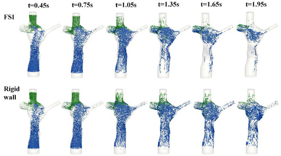 Biology | Free Full-Text | Fluid-Structure Interaction Simulation of an ...