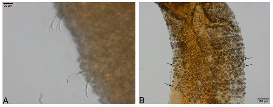 The Foreign Oligochaete Species Quistadrilus multisetosus (Smith, 1900 ...