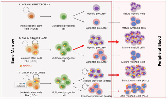 Future Approaches for Treating Chronic Myeloid Leukemia: CRISPR Therapy