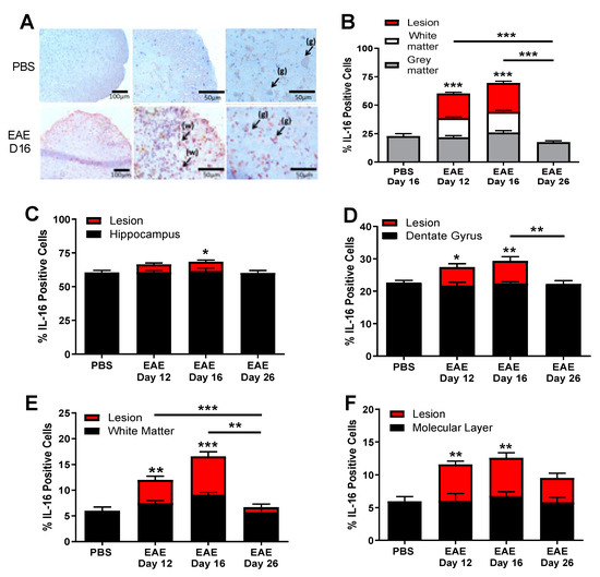 Increased Levels of IL-16 in the Central Nervous System during ...