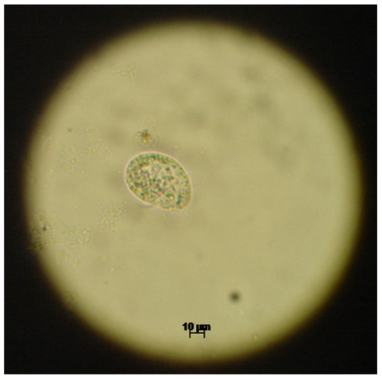 When a Ciliate Meets a Flagellate: A Rare Case of Colpoda spp. and ...