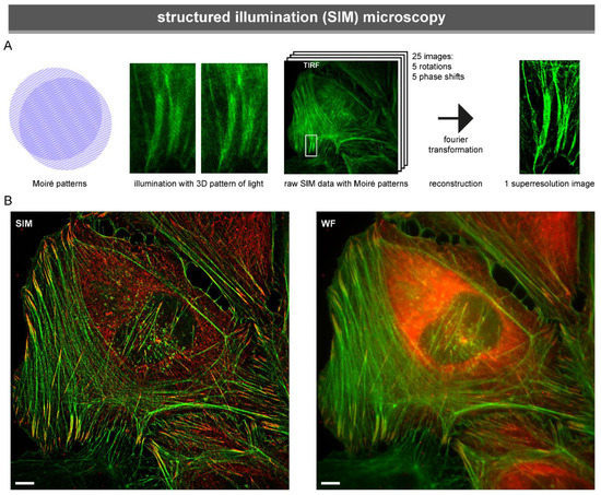 A Layered View on Focal Adhesions