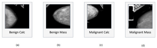 Biology | Free Full-Text | BreastNet18: A High Accuracy Fine-Tuned ...