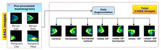 BreastNet18: A High Accuracy Fine-Tuned VGG16 Model Evaluated Using ...