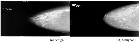 Architectural Distortion-Based Digital Mammograms Classification Using ...