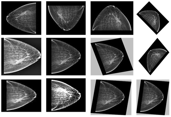 Architectural Distortion-Based Digital Mammograms Classification Using ...