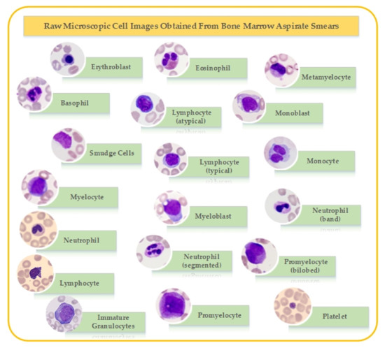 Synthesis of Microscopic Cell Images Obtained from Bone Marrow Aspirate ...