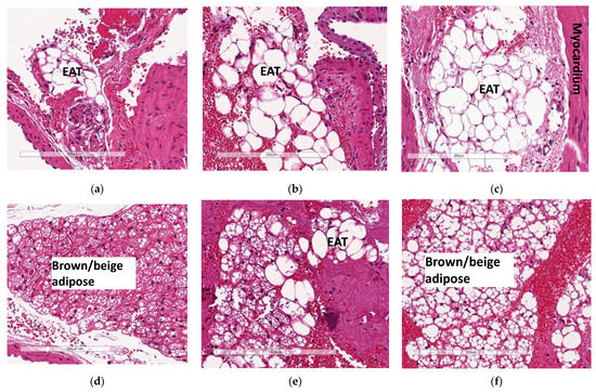 Slc7a8 Deletion Is Protective against Diet-Induced Obesity and ...