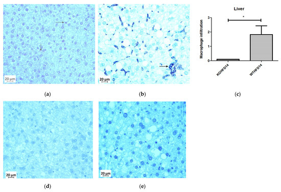 Slc7a8 Deletion Is Protective against Diet-Induced Obesity and ...