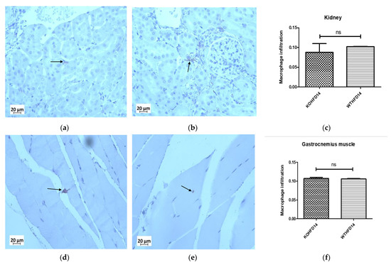 Slc7a8 Deletion Is Protective against Diet-Induced Obesity and ...