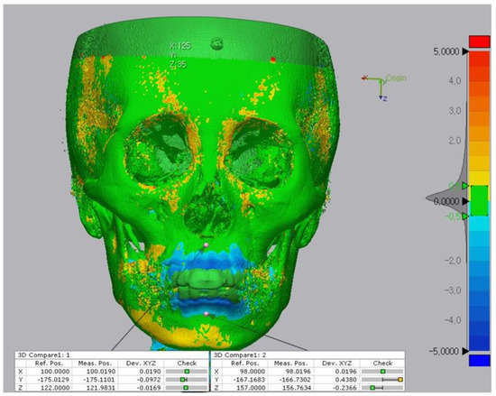 Three-Dimensional Digital Image Analysis of Skeletal and Soft Tissue ...