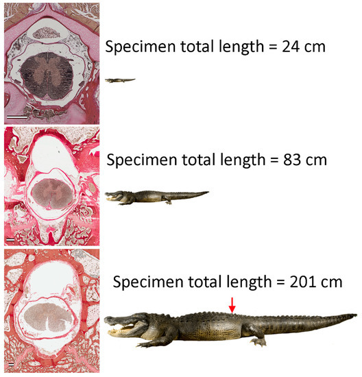 Morphometrics of the Spinal Cord and Surrounding Structures in ...