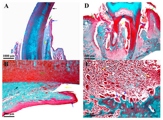 Comparative Testing of Two Ligature-Induced Periodontitis Models in ...