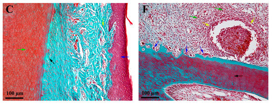 Comparative Testing of Two Ligature-Induced Periodontitis Models in ...