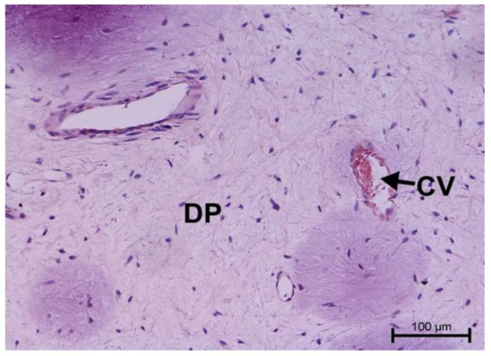 Detection of Lymphatic Vessels in Dental Pulp