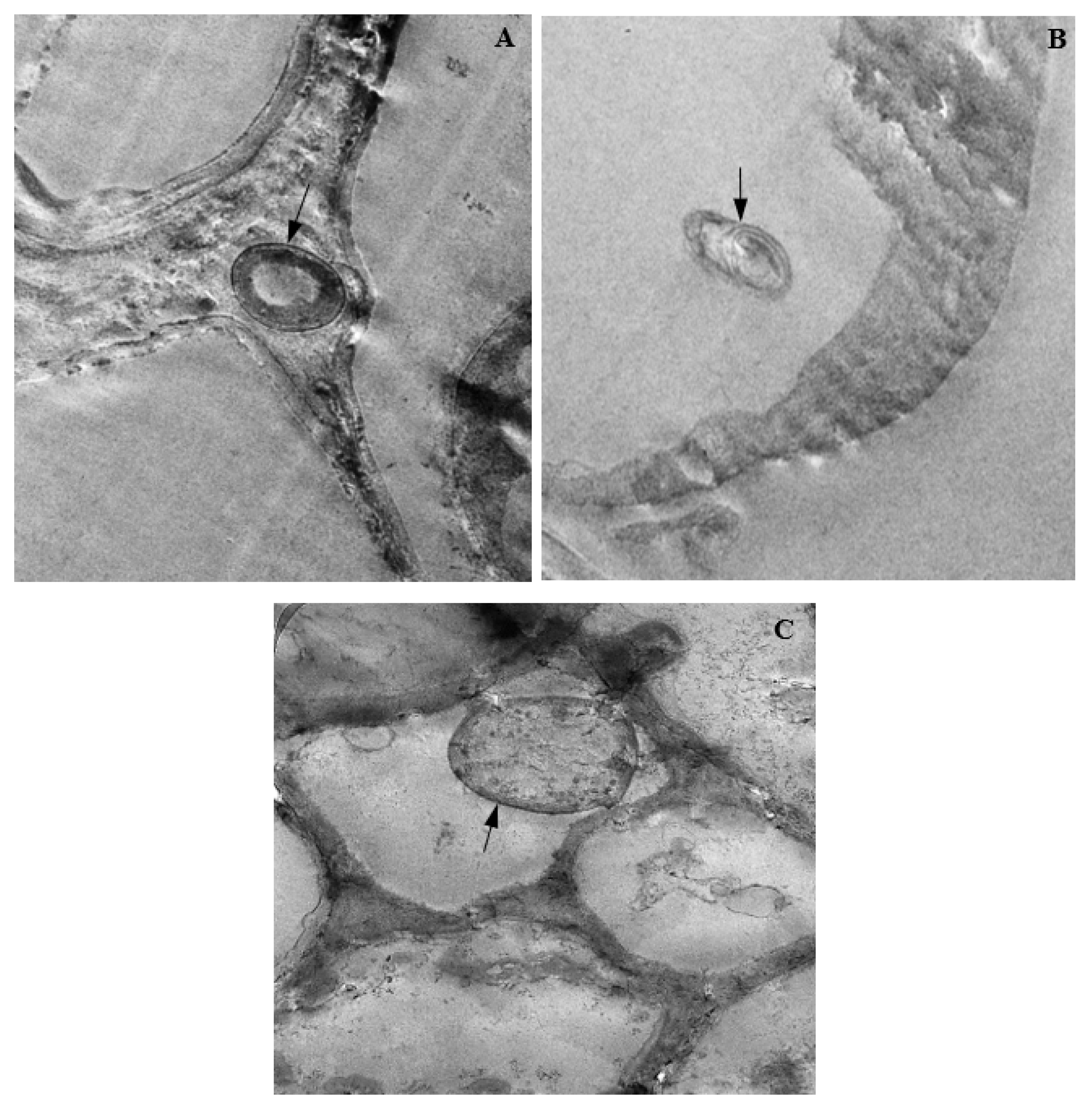 Histopathology of Corn Plants Infected by Endophytic Fungi