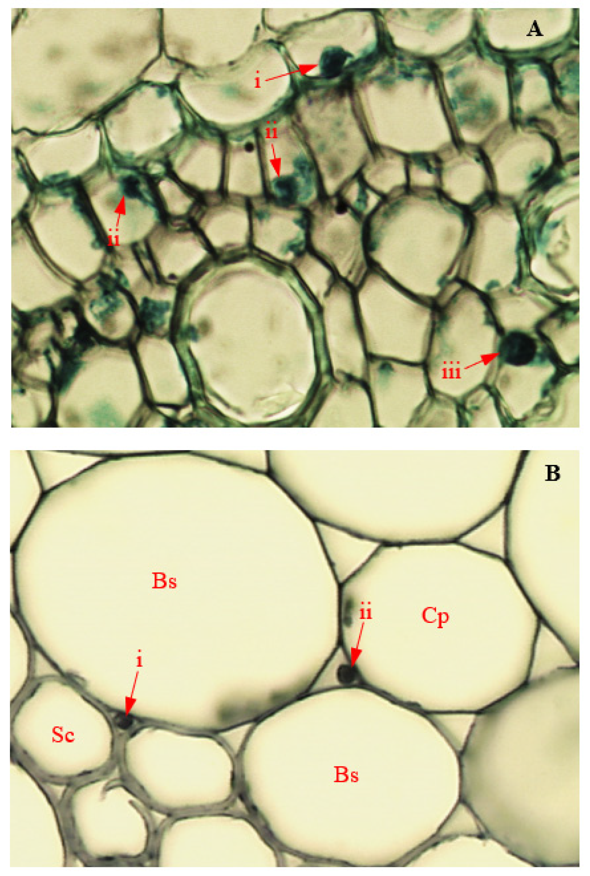 Histopathology of Corn Plants Infected by Endophytic Fungi