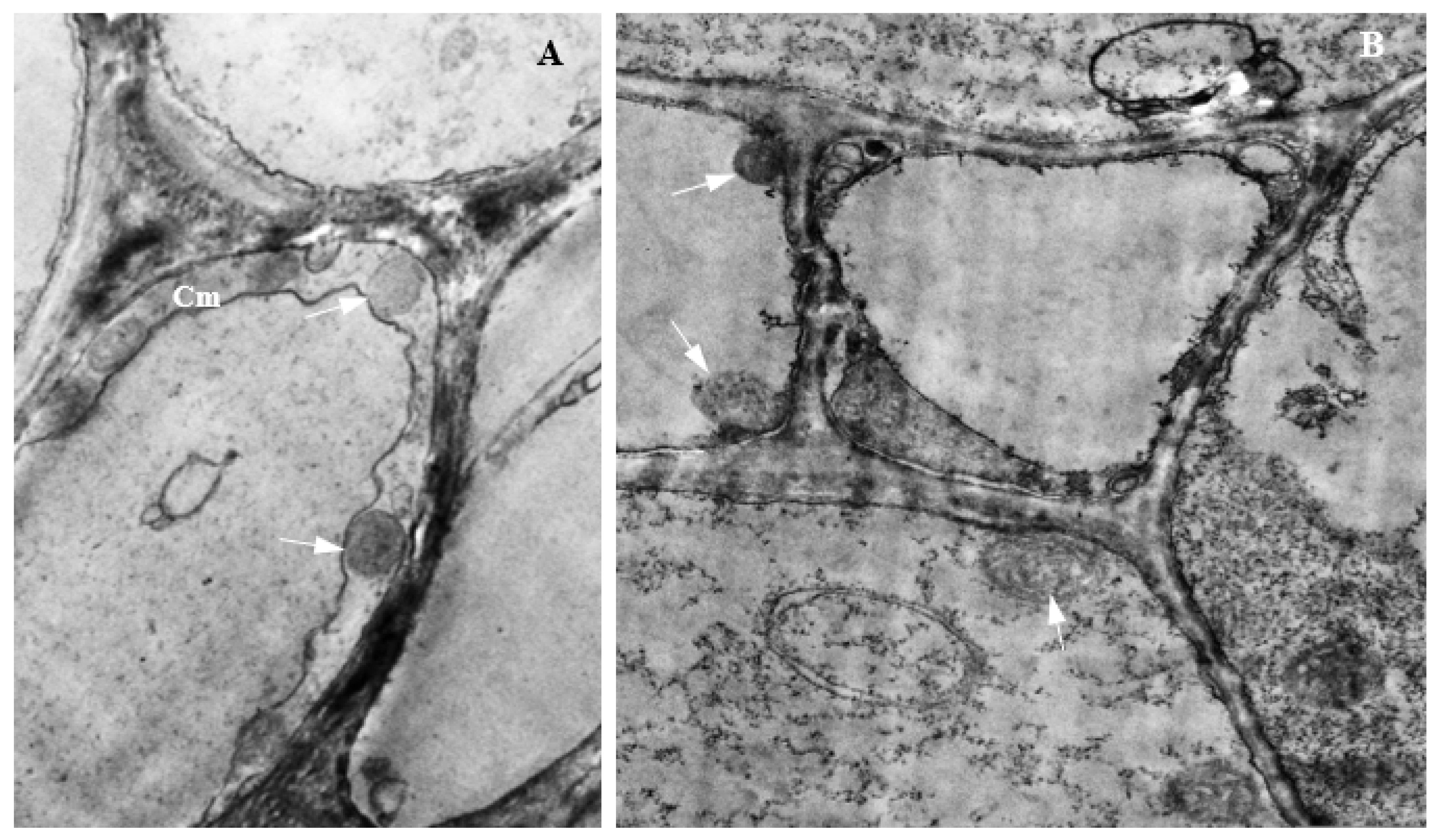 Histopathology of Corn Plants Infected by Endophytic Fungi