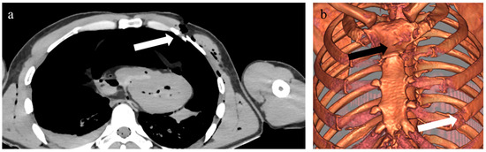Biology | Free Full-Text | Perimortem Skeletal Sharp Force Trauma ...