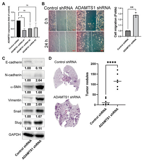 Downregulated ADAMTS1 Incorporating A2M Contributes to Tumorigenesis ...