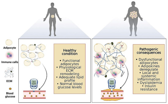 Adipose Tissue Extracellular Matrix Remodeling in Response to Dietary ...