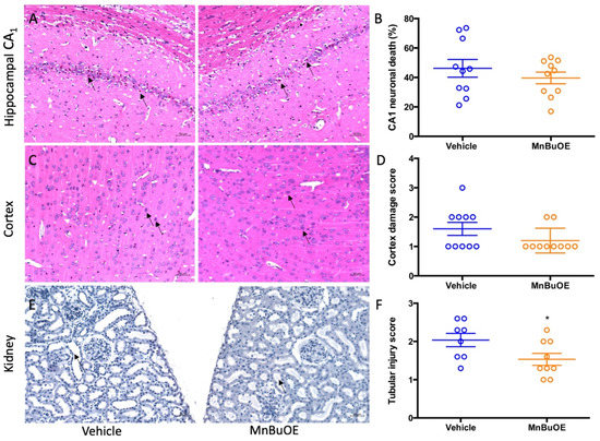 Biology | Free Full-Text | Manganese Porphyrin Promotes Post Cardiac ...