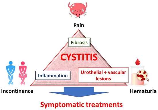 Biology | Free Full-Text | Molecular Mechanisms and Key Processes in ...