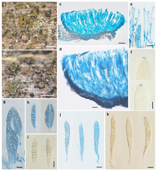 Additions to the Knowledge of the Genus Pezicula (Dermateaceae ...