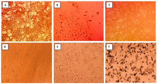 Isolation, Propagation and Genotyping of Human Rotaviruses Circulating ...