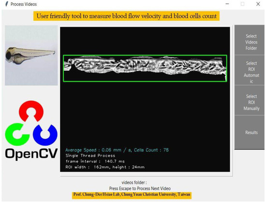OpenBloodFlow: A User-Friendly OpenCV-Based Software Package for Blood Flow Velocity and Blood ...