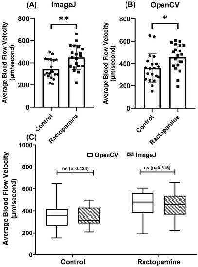 OpenBloodFlow: A User-Friendly OpenCV-Based Software Package for Blood ...