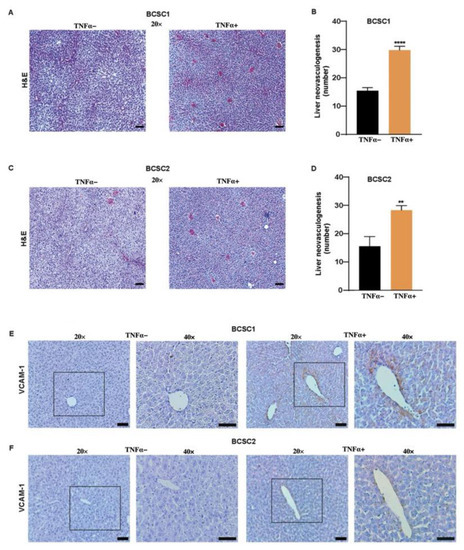 Tumor Necrosis Factor-α (TNFα) Stimulates Triple-Negative Breast Cancer ...