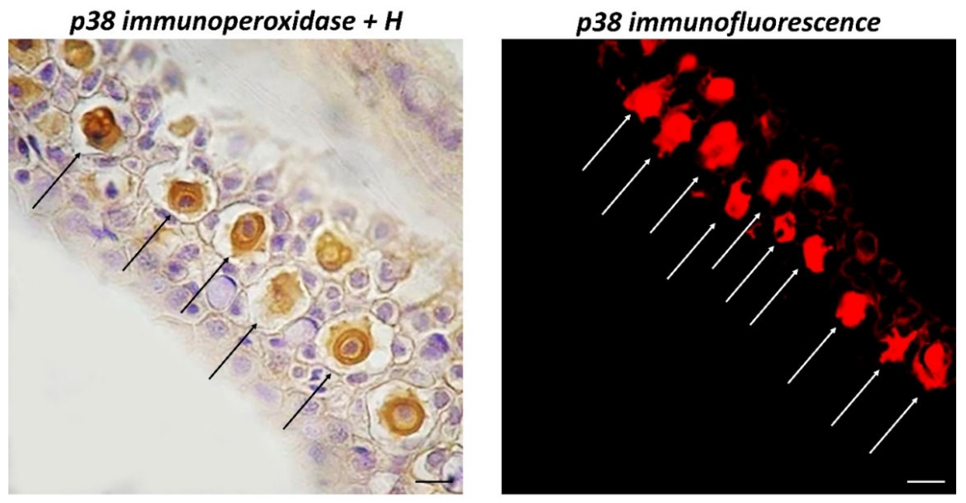 Confocal Identification of Immune Molecules in Skin Club Cells of ...