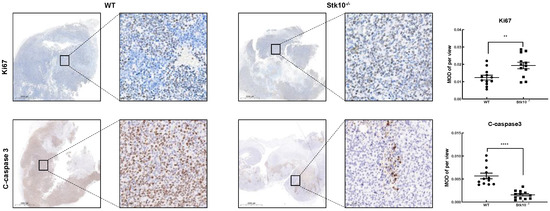 Stk10 Deficiency in Mice Promotes Tumor Growth by Dysregulating the ...