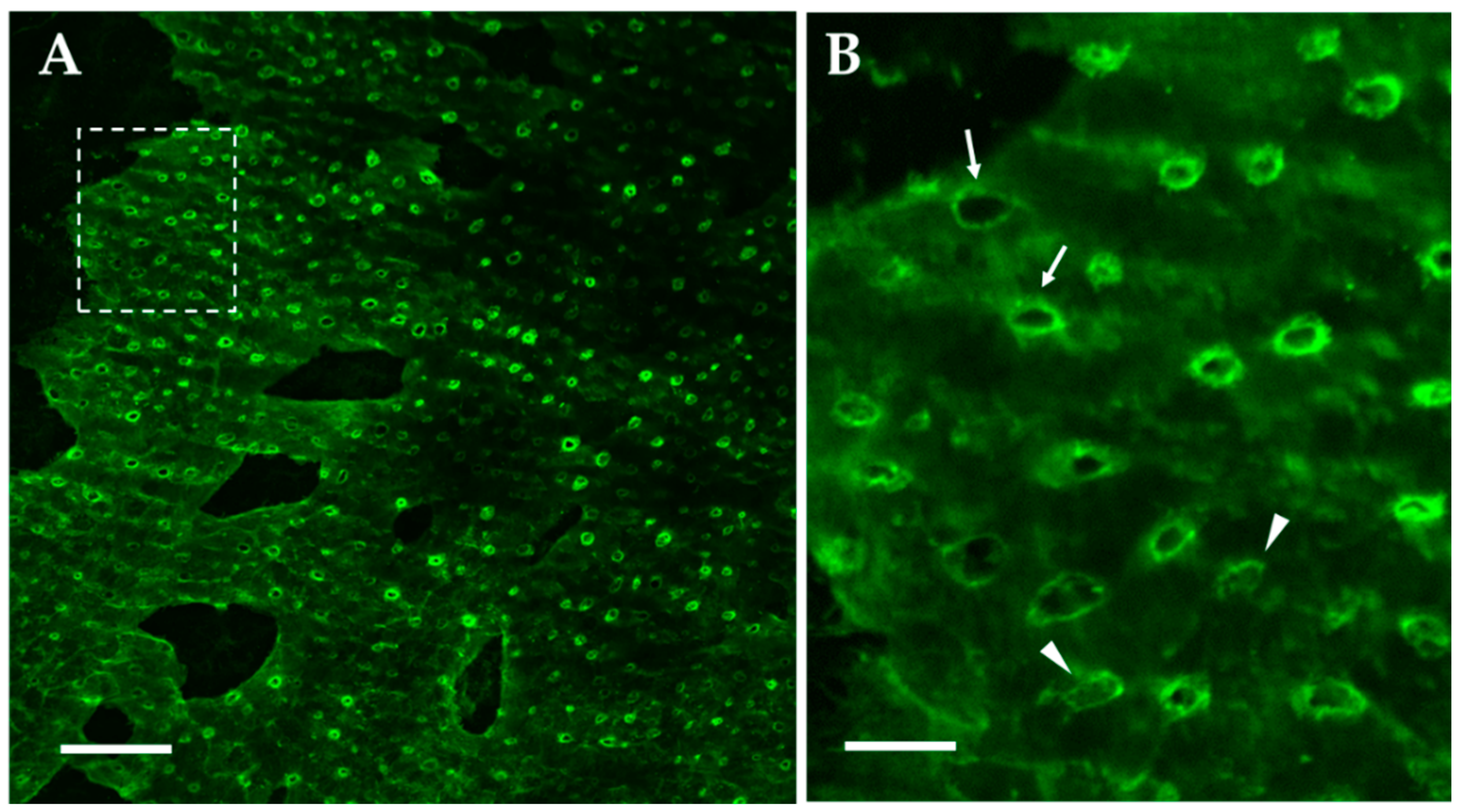 Morphological, Mechanical and Hydrodynamic Aspects of Diaphragmatic ...