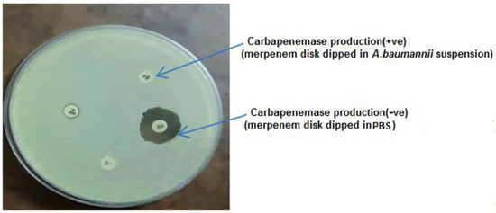 Acinetobacter On Blood Agar