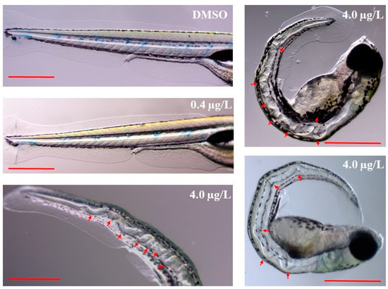 Transcriptome Analysis of Thiram-Treated Zebrafish (Danio rerio ...