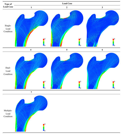 Quantitative Load Dependency Analysis of Local Trabecular Bone Microstructure to Understand the ...