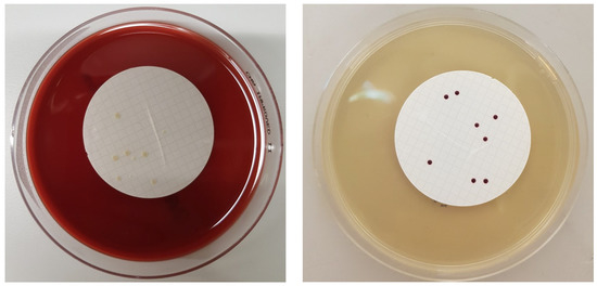 Dissolved Carbon Dioxide: The Lifespan of Staphylococcus aureus and ...
