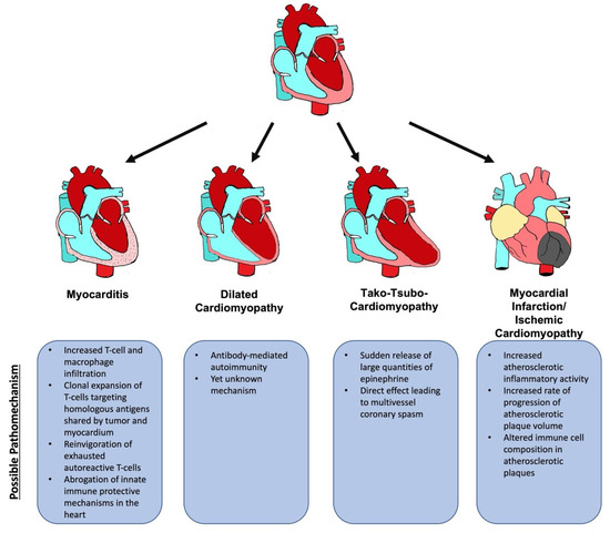 Immune Checkpoint Inhibitor Associated Myocarditis and Cardiomyopathy ...