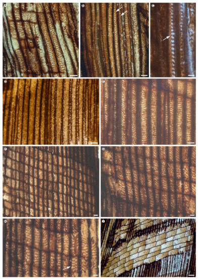 Stem Anatomy Confirms Tingia unita Is a Progymnosperm