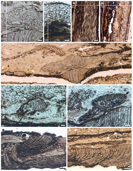 Stem Anatomy Confirms Tingia unita Is a Progymnosperm