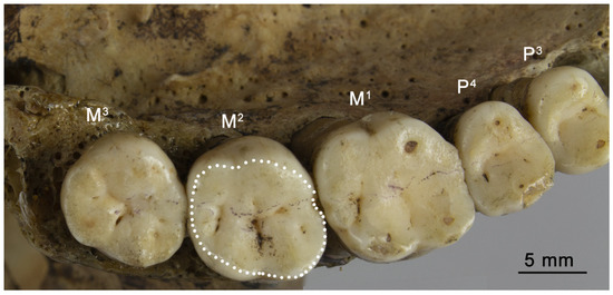 Assessment of the Relationship between the Total Occlusal Area of the ...