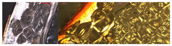 Automatic Segmentation of Osteonal Microstructure in Human Cortical ...
