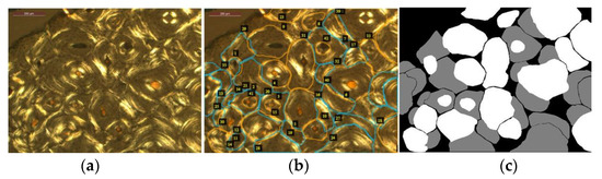 Biology | Free Full-Text | Automatic Segmentation of Osteonal ...