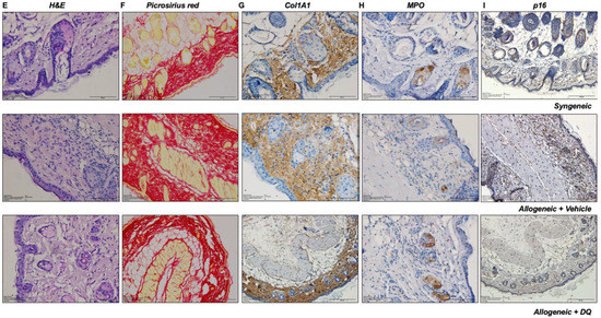 Therapeutic Potential of a Senolytic Approach in a Murine Model of ...